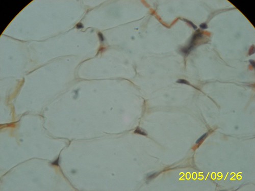 Histology Lab Exam Flashcards Quizlet